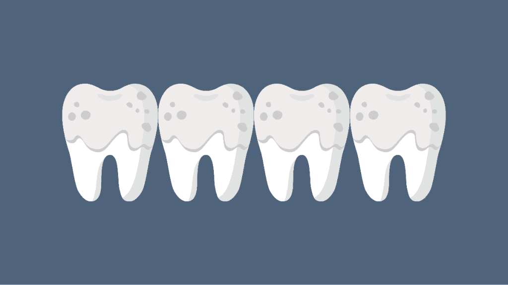Materia Alba : Materia Alba vs Plaque vs Calculus - 2025