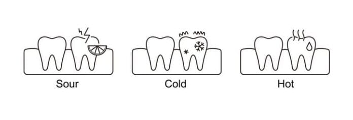 Teeth sensitivity or Dentin hypersensitivity : Causes, Treatment